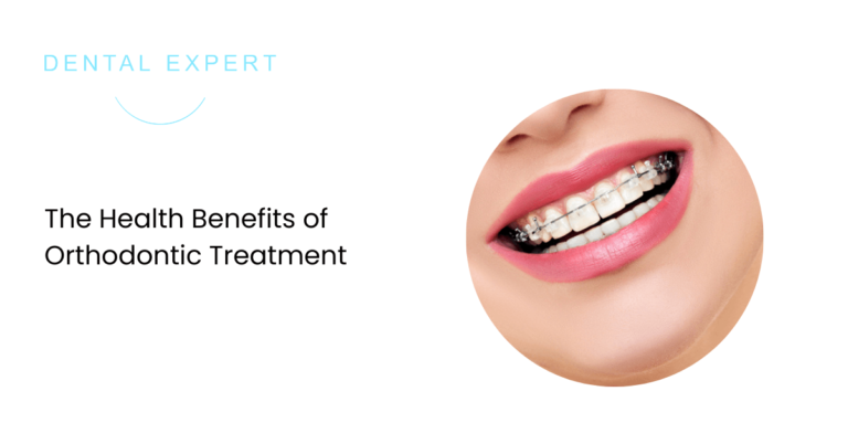 The Health Benefits Of Orthodontic Treatment Dental Expert Clinic