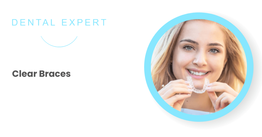 Get Clear Braces to Get a Perfect Smile | Dental Expert Clinic
